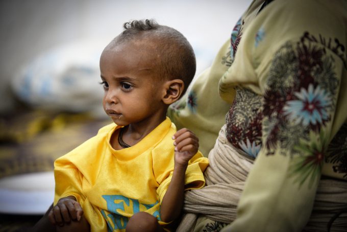 Miljoenen kinderen ernstig ondervoed door hongersnood Oost-Afrika ...
